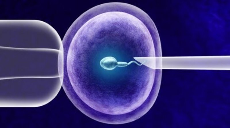 In vitro fertilization (IVF) | Welcome - RECMED